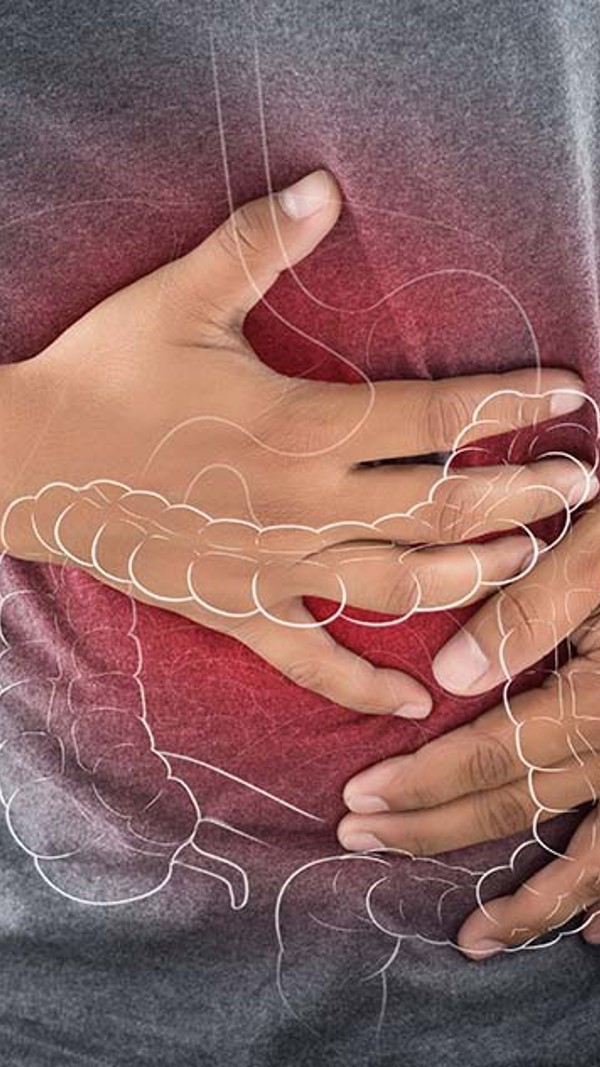 Crohn's & Colitis UK - Symptom checker